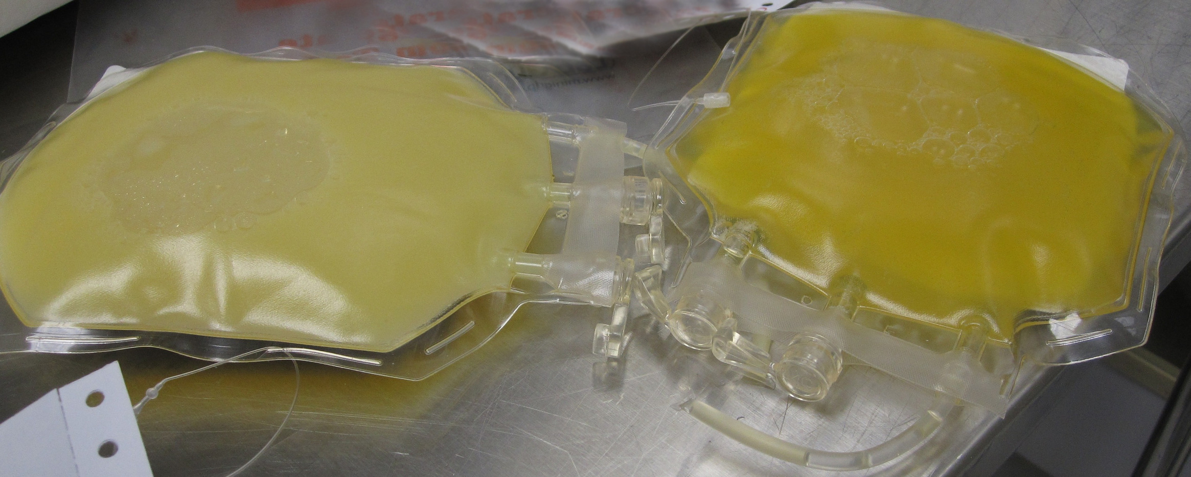 COVID-19: What Is Convalescent Plasma? – The Wire Science