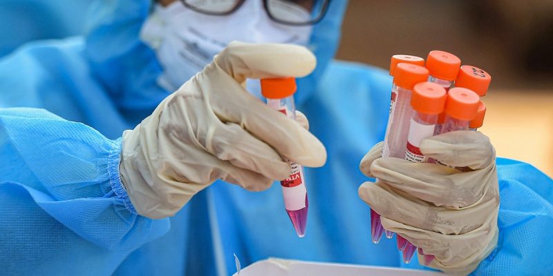 Delhi Govt Caps RT-PCR Test Price at Rs 800, Down From Rs 2,400