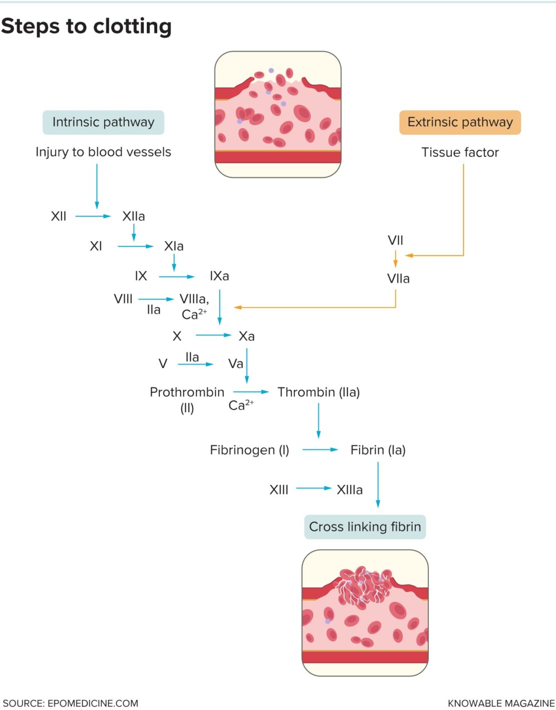 Review: Why Are Blood Clots Such a Major Problem in Severe COVID-19 ...
