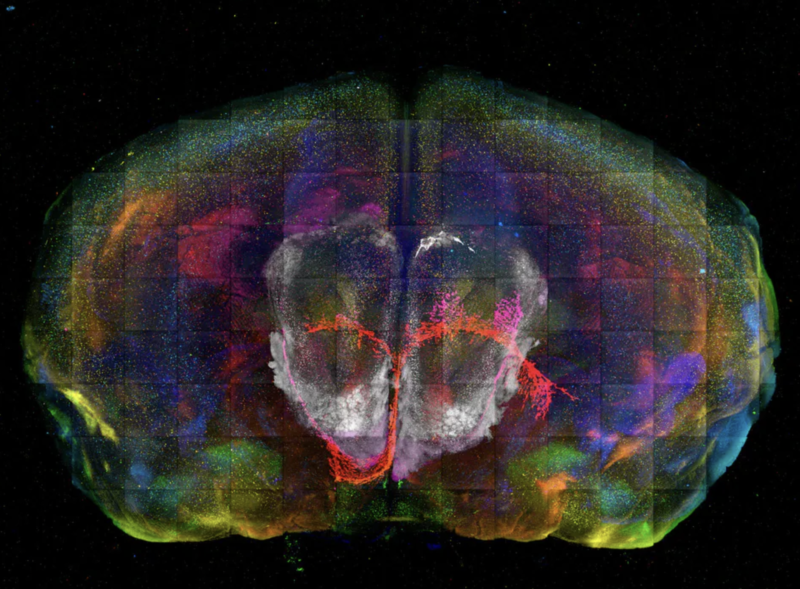 Brave New World of Neuroscience: Mapping How the Brain’s 100 Billion ...