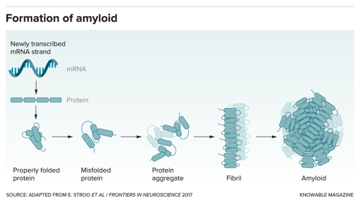 Amyloidosis: Beyond Alzheimer’s and Parkinson’s – The Wire Science